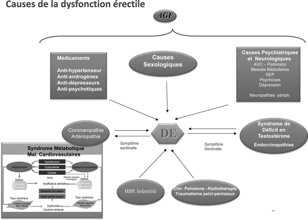 Dysfonction érectile – Définition et diagnostic et solution
